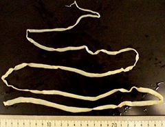 Alam mo ba?: Human Tapeworm (Ulay)